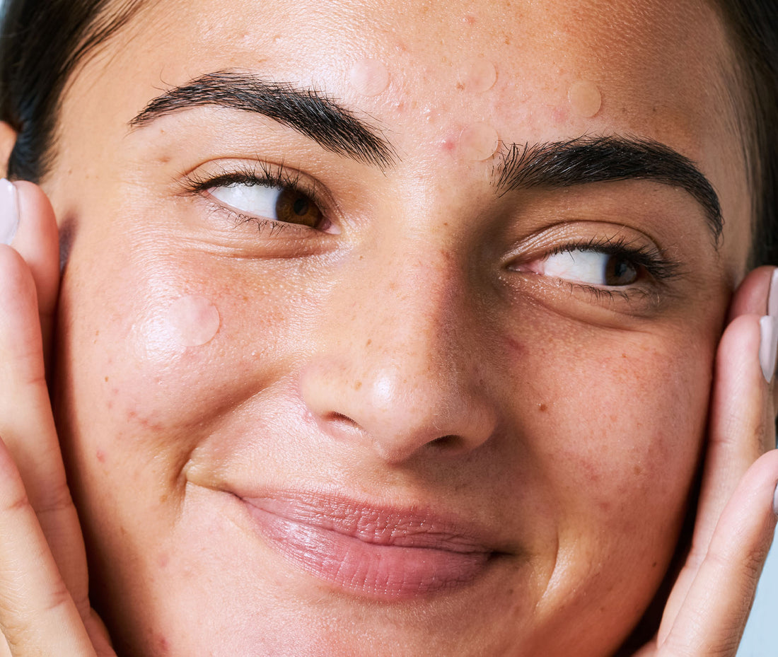 Nose Pore Patches - Blemish Patches | Peach & Lily