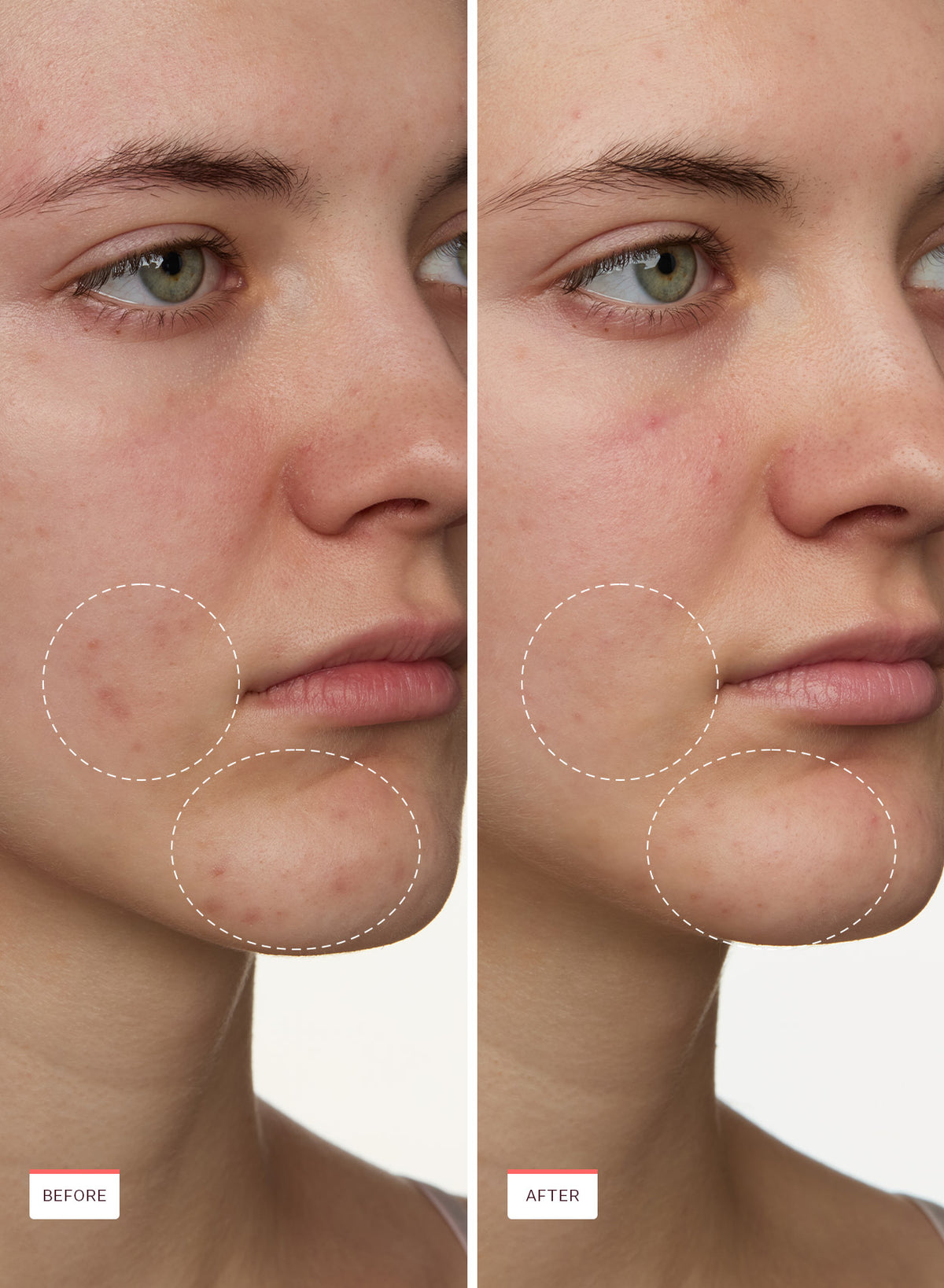 Super Fade Discoloration Serum | Dark Spots Skin Corrector