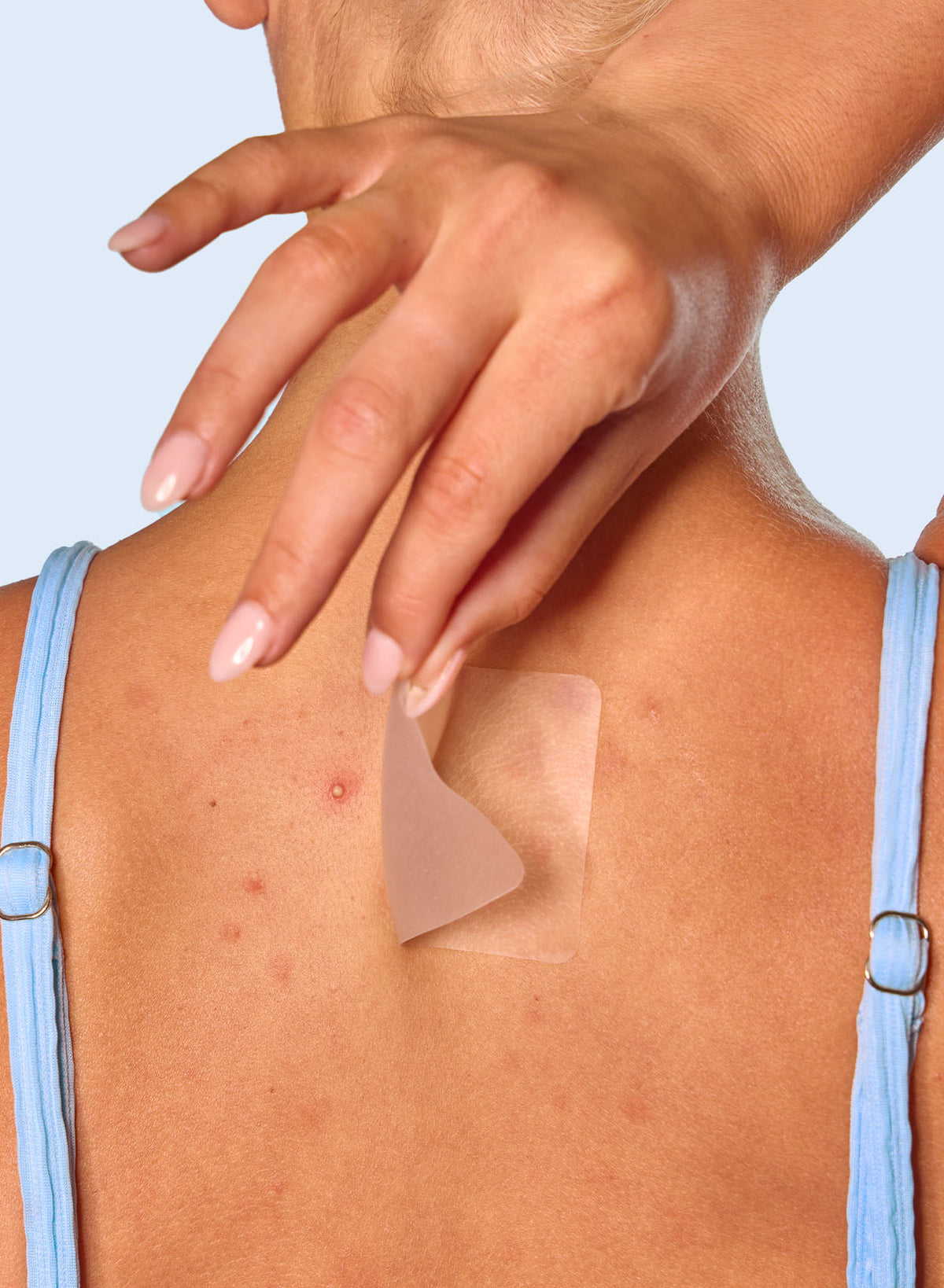 Body Breakout Patches (6pk) - Body Acne Spot Dots