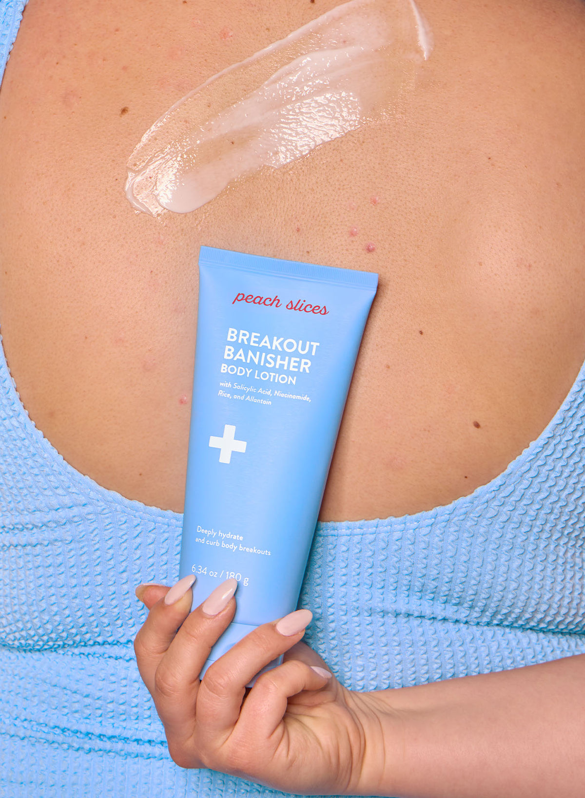 Breakout Banisher Body Lotion - Body Acne Lotion