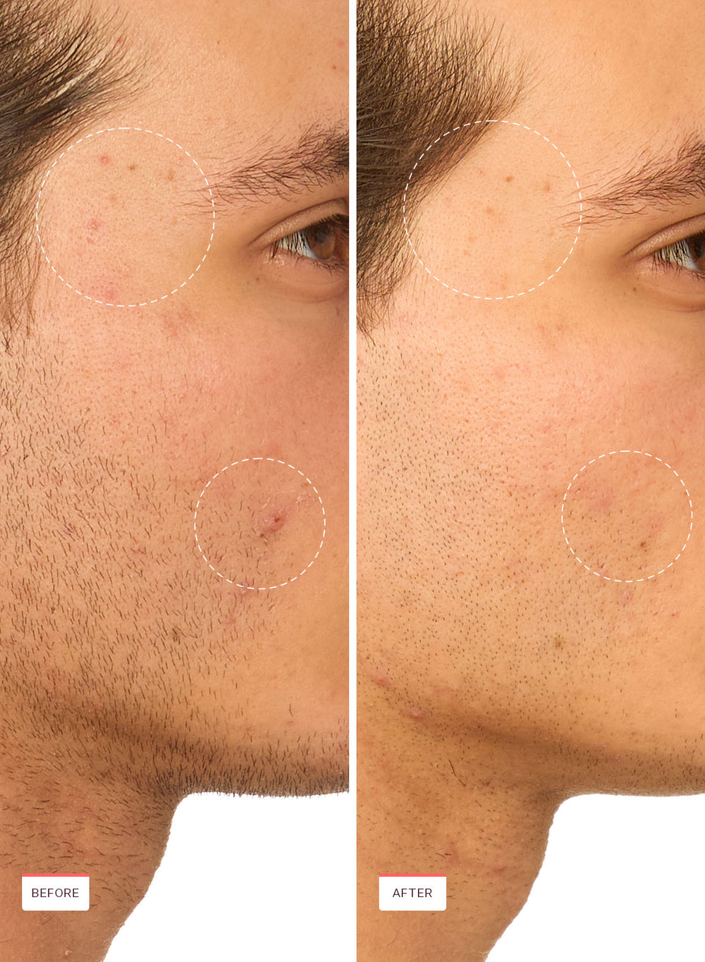 Peach Slices Snail Rescue Blemish Busting Toner w/ Snail Mucin