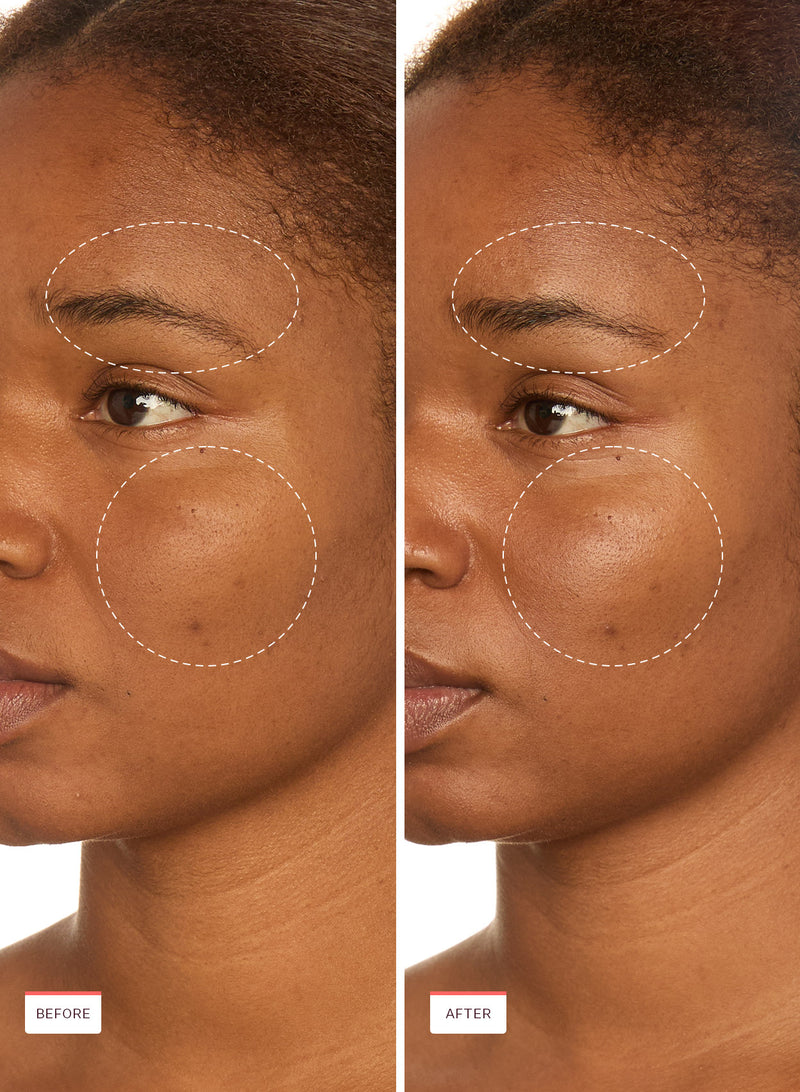 Peach Slices Snail Rescue All-In-One Deep Moisture Cream | Peach & Lily